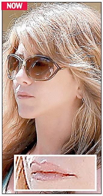Exclusive Jennifer Aniston Reveals Her Plump New Pout As Her 40th
