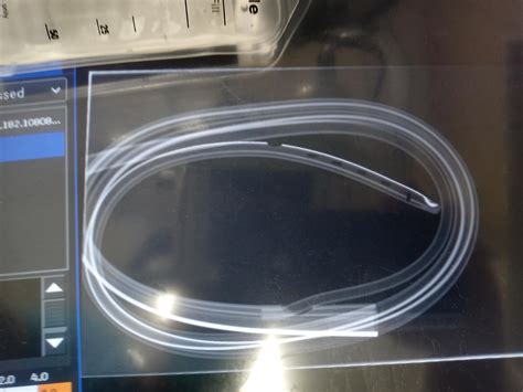 Feeding Tubes On X Ray Ngt And Dht Dobhoff R Radiology