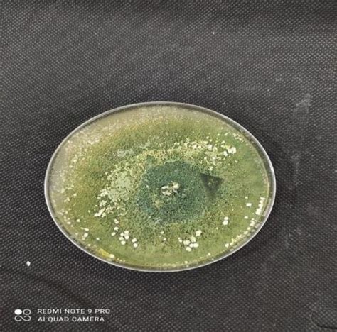 Isolate Of Trichoderma In Pda Medium For A Trichoderma Download Scientific Diagram