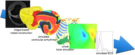 Virtual Pace Mapping For Optimised Planning Of Catheter Ablation