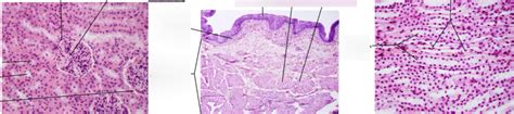 Anatomy Lab 212 Test 4 Urinary System Histology Diagram Quizlet
