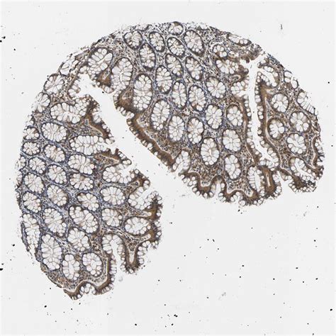 Tissue Expression Of Ddr1 Staining In Colon The Human Protein Atlas