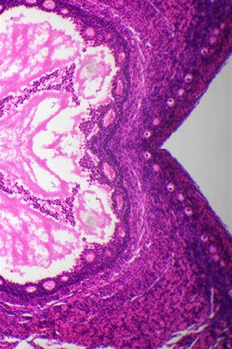 Clinical Features Of Pcos Intechopen