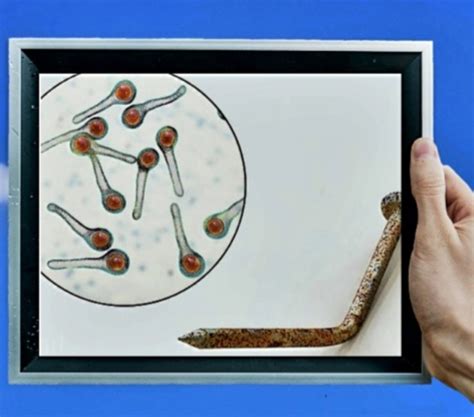 파상풍 초기증상 및 예방주사 접종 시기 비용 파상풍균 치사율 네이버 블로그