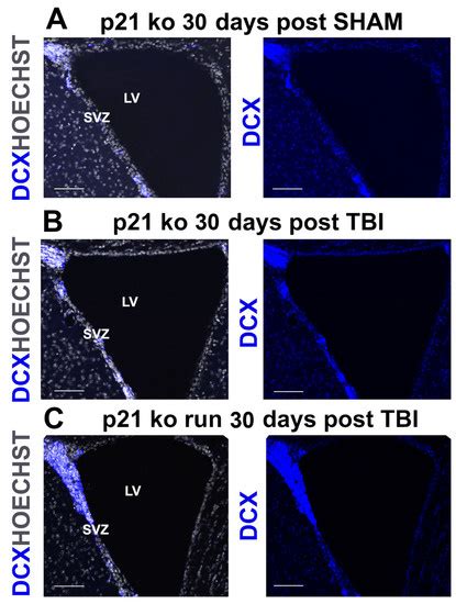 Role Of Running Activated Neural Stem Cells In The Anatomical And