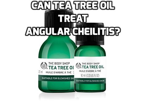 Is Tea Tree Oil Great For Treating Angular Cheilitis Anti Aging Beauty Health And Personal Care