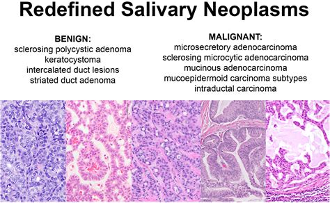 Salivary Glands Histology