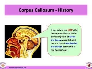 Corpus Callosum Anomalies Pdf