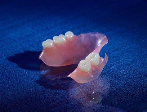 Valplast Success With Partial Dentures Burbank Dental Lab
