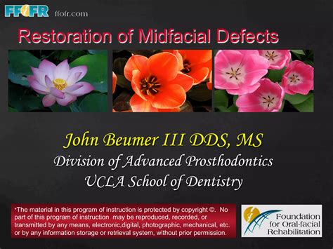 Restoration Of Midfacial Defects Pdf