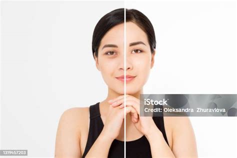 아시아 는 화장품 절차 후 전에 여자 행복 얼굴을 닫습니다 피부 관리 주름 얼굴 눈 아래 다크 서클 노화 방지 페이스 리프트