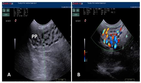 Ultrasonographic Imaging Of Post Pubertal Mature Rams In Spermatic Cord