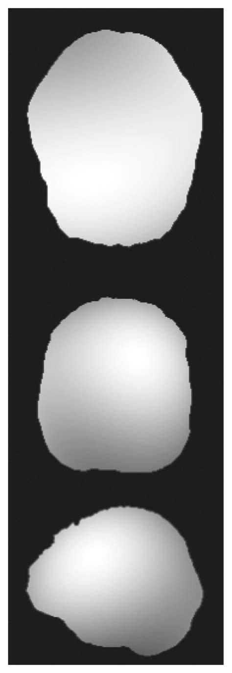 Intensity Inhomogeneity Correction Of Brain Mr Images A Original Mr Download Scientific
