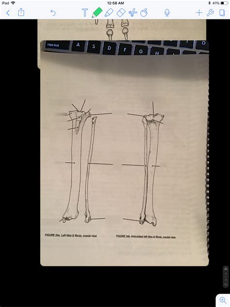 Tibia Fibula Diagram Quizlet
