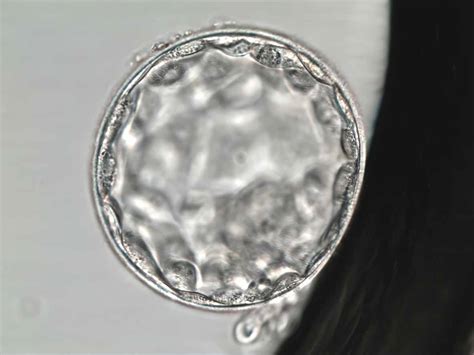 Embryo Screening In Ivf Everything You Need To Know Ferticentro