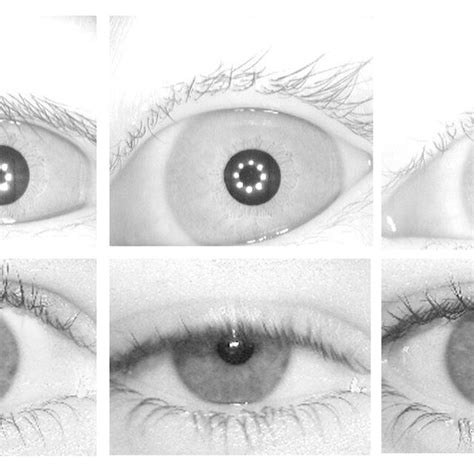 In The Figure The Above Three Irises Are The Same Person Iris Download Scientific Diagram