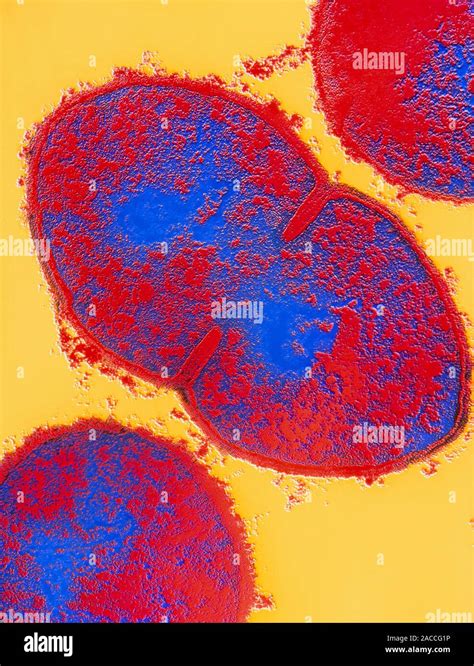 Resistant Streptococcus Strain Coloured Transmission Electron Micrograph Of A Dividing