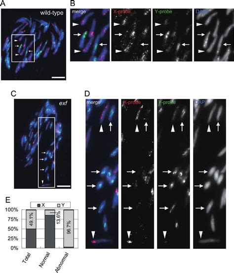 Abnormal Spermatid Nuclei Contain The Y Chromosome A Wild Type