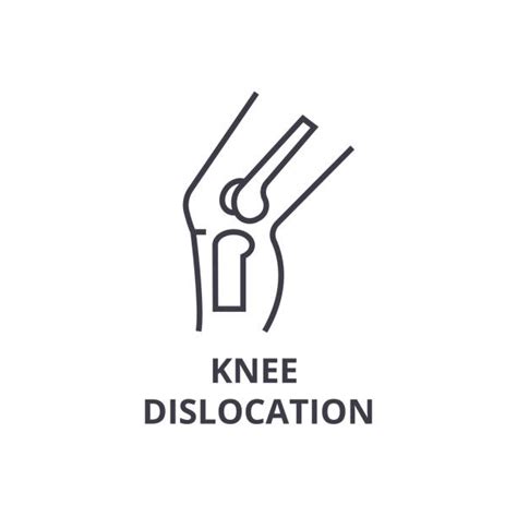 Dislocation Illustrations Royalty Free Vector Graphics And Clip Art Istock