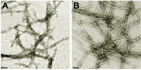 Figure 1 From Assays For Studying Nucleated Aggregation Of
