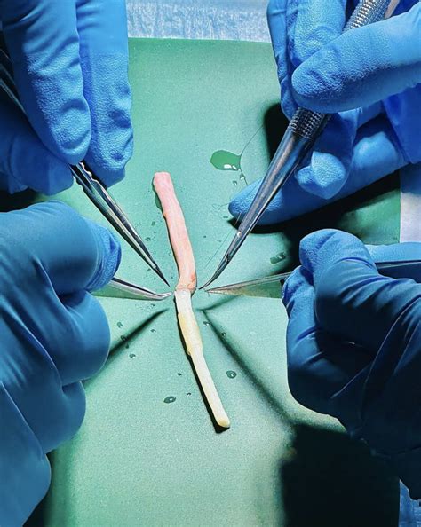 Breast Cancer Surviving Surgeon Urges Profession To Consider ‘sensation