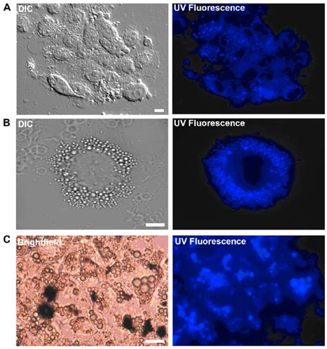 Broncho Epithelial Cells Alveolar Macrophages And Adipocytes Display