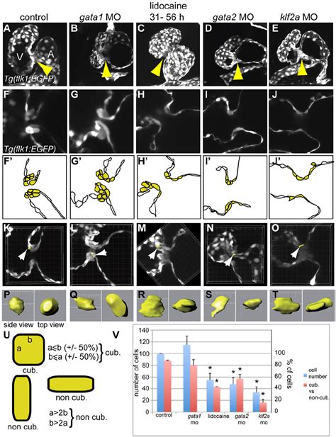 Comparison Of The Valve Phenotype Between The Different Treatments