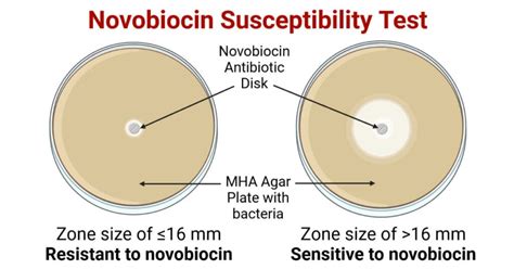 Novobiocin Susceptibility Test Principle Procedure Results