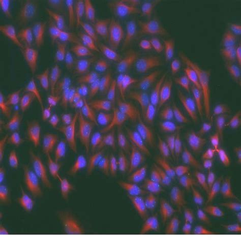 Image Deconvolution 101 Guide To Crisp Microscopy