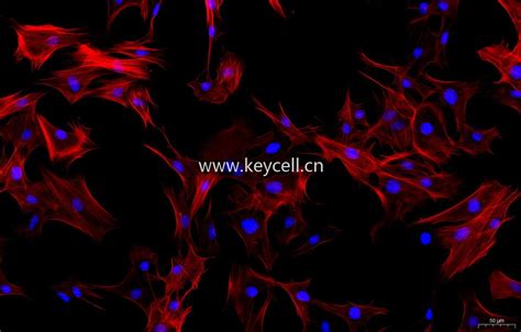 大鼠胰腺星状细胞永生化免疫荧光鉴定 细胞系 细胞库 旗赛生物科技武汉有限公司