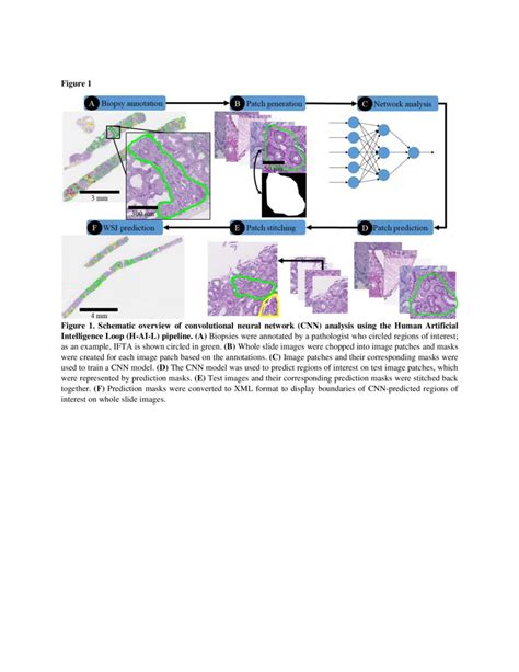 Neural Network Segmentation Of Interstitial Fibrosis Tubular Atrophy