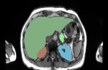 Python 3 X Aligning Nifti Files With Different Shape And Q Offset