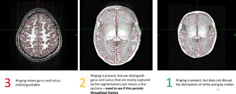 Post Processing Quality Assessment From Executive Summary Dcan Labs