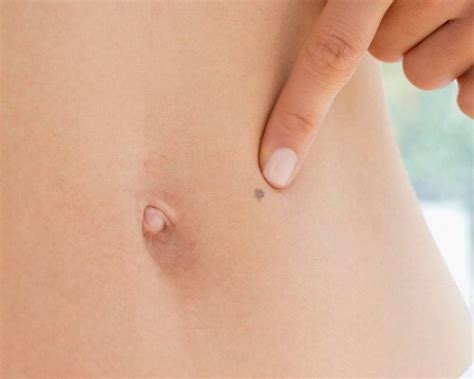 Рак Кожи Фото Симптомы — Фото