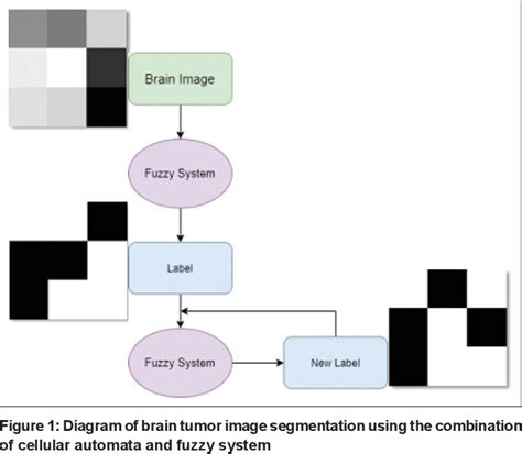 Figure 1 From Brain Tumor Segmentation Using Hierarchical Combination Of Fuzzy Logic And