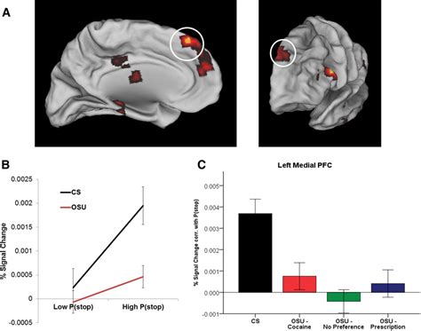 Model Based Fmri Data Analysis Coding Of Pstop Magnitude In The Left