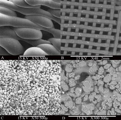 Scanning Electron Microscopy Of The Area Of The Outer And Inner