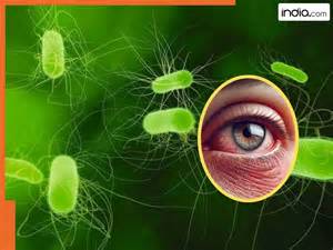 अंदर ही अंदर आंखों को खा जाता है ये बैक्टीरिया जानें Pseudomonas
