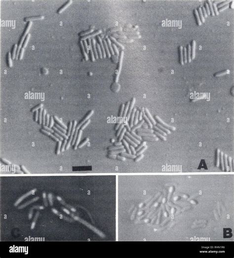 Bacterial Spores Slide