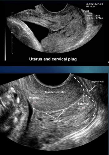 Module 14 Notes 2nd 3rd Trimester Pregnancy Flashcards Quizlet
