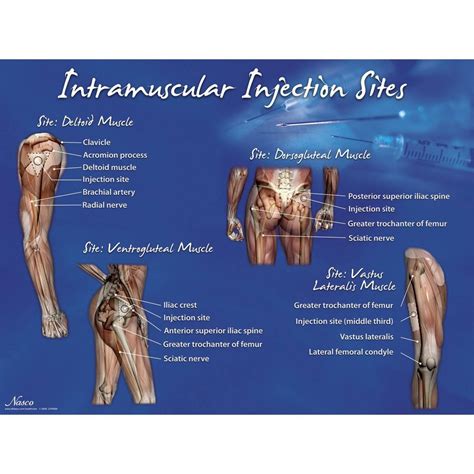 Nasco Healthcare Intramuscular Injection Visual Aid Chart Anatomy Warehouse
