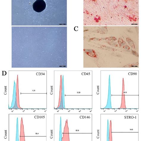 Immunofluorescence Analysis Of Runx2 Expression In Hpdlscs After
