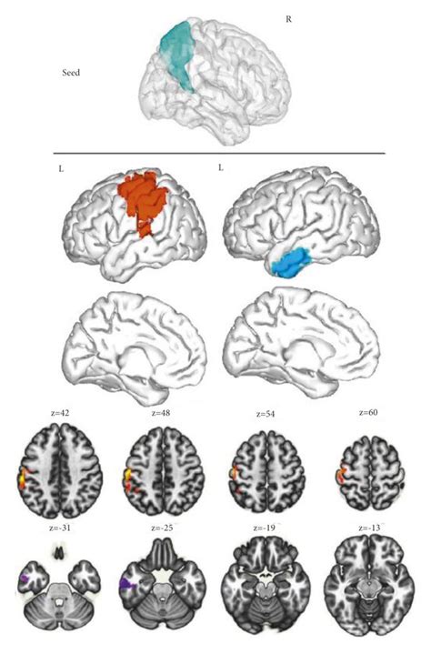 Functional Connectivity Analysis Based On The Region Of Interest