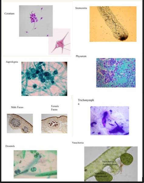 Solved Study The Slides Of Protists That Are Evailable In Solved Study The Slides Of Protists That Are Evailable In
