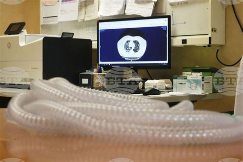 Учени откриха първите доказателства за увреждания свързани с КОВИД 19