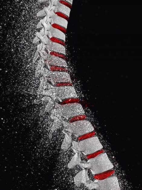 Gabapentin And Spinal Surgery