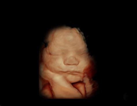 Private 4d Hd Live Ultrasounds At White Stork And Co Nashville Tn