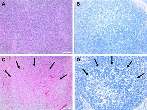 Normal Histology Of A Porcine Lymph Node A B And Histopathology Of A