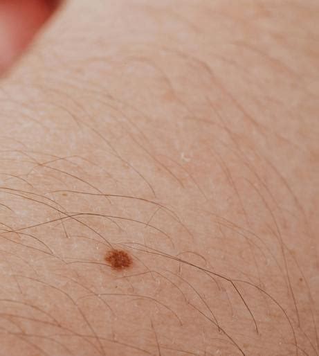 Follicle Stimulating Hormone Medshun