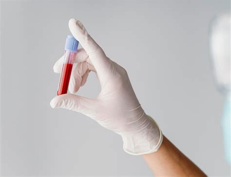 STD Screening Radium Medical Aesthetics Singapore